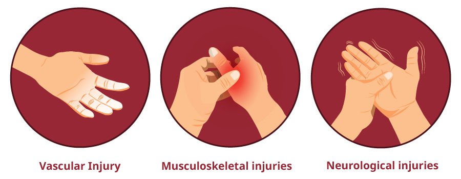 Hand Arm Vibration Syndrome Symptoms | Thompsons Scotland